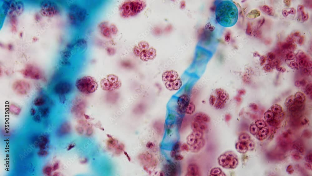 Signema algae under microscope. Study of morphology, physiology and ...