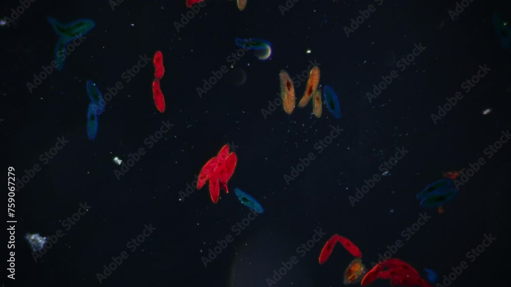 Microscopic predator (Paramecium) under microscope. 100x times ...