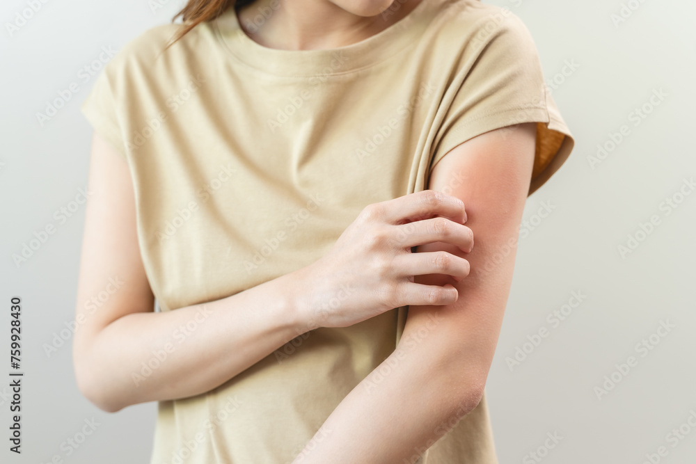 young woman scratching on her arm and has a red rash irritation on her ...