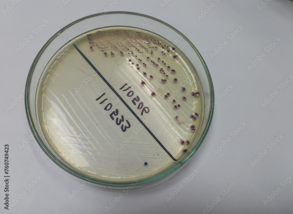 Technologist holds Bacteria culture growth on chromogenic media plate ...