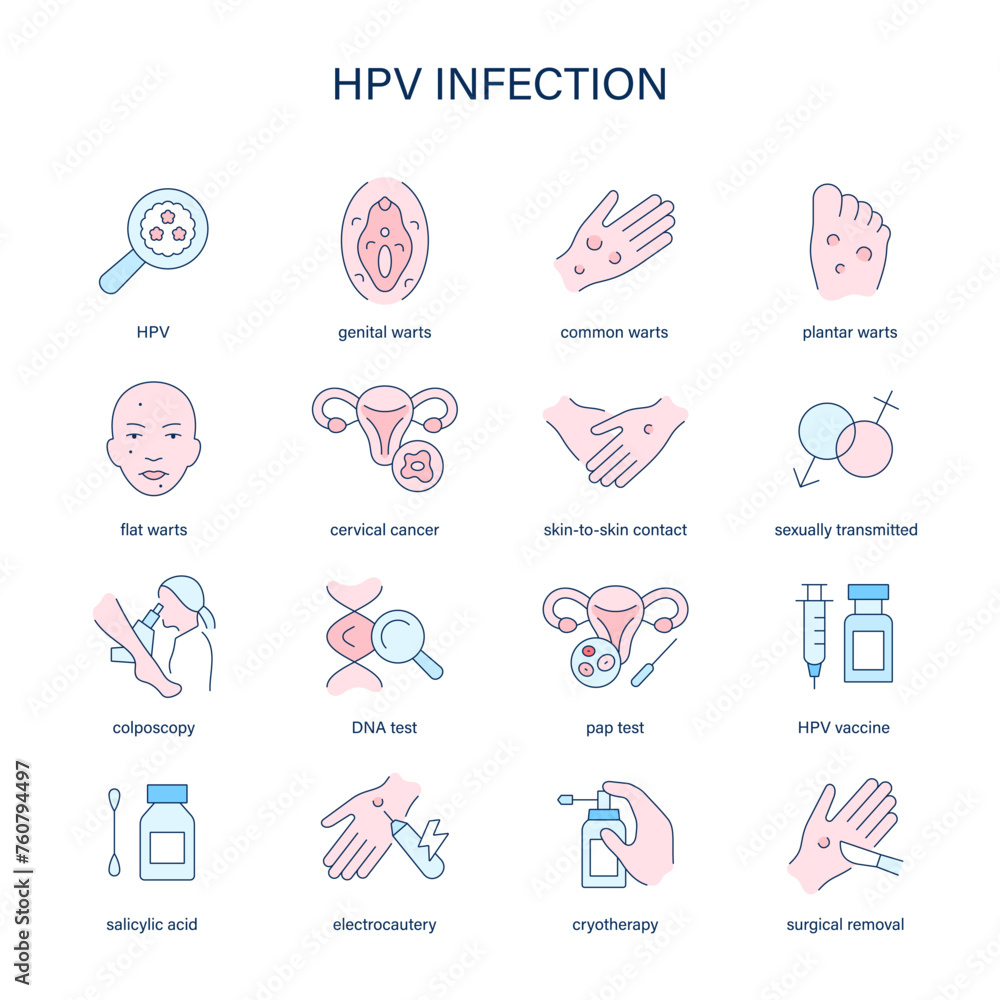 Vetor de HPV Infection symptoms, diagnostic and treatment vector icons ...