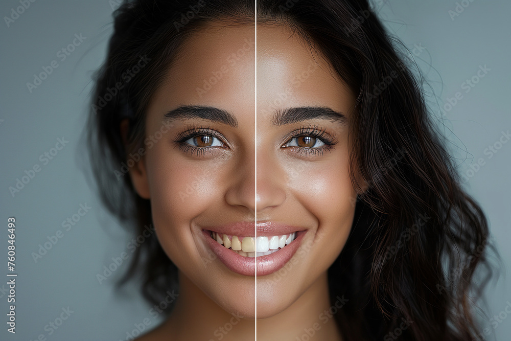 Professional teeth whitening and cleaning. Young smiling woman showing ...