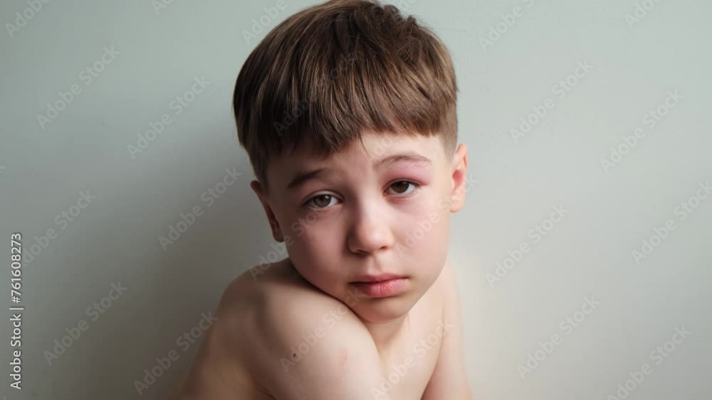 Portrait of unhappy tired boy looking and blinking at the camera with ...