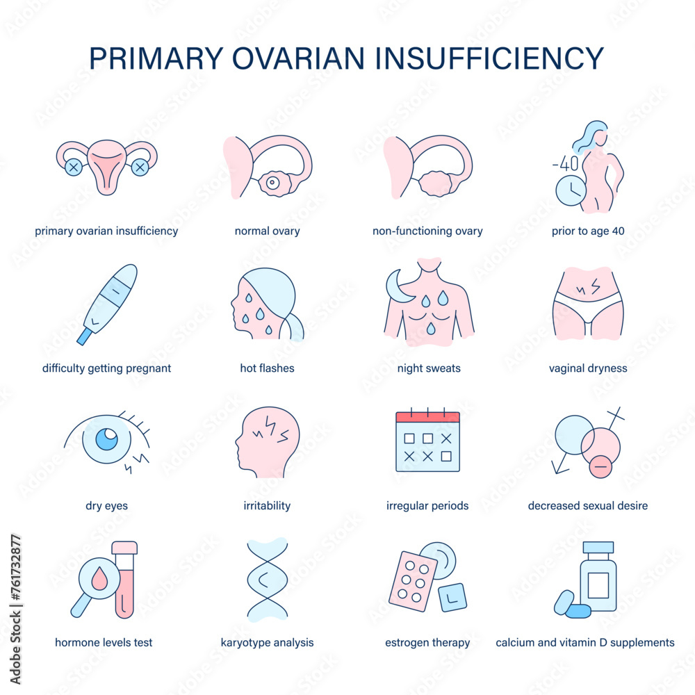 Primary Ovarian Insufficiency symptoms, diagnostic and treatment vector ...
