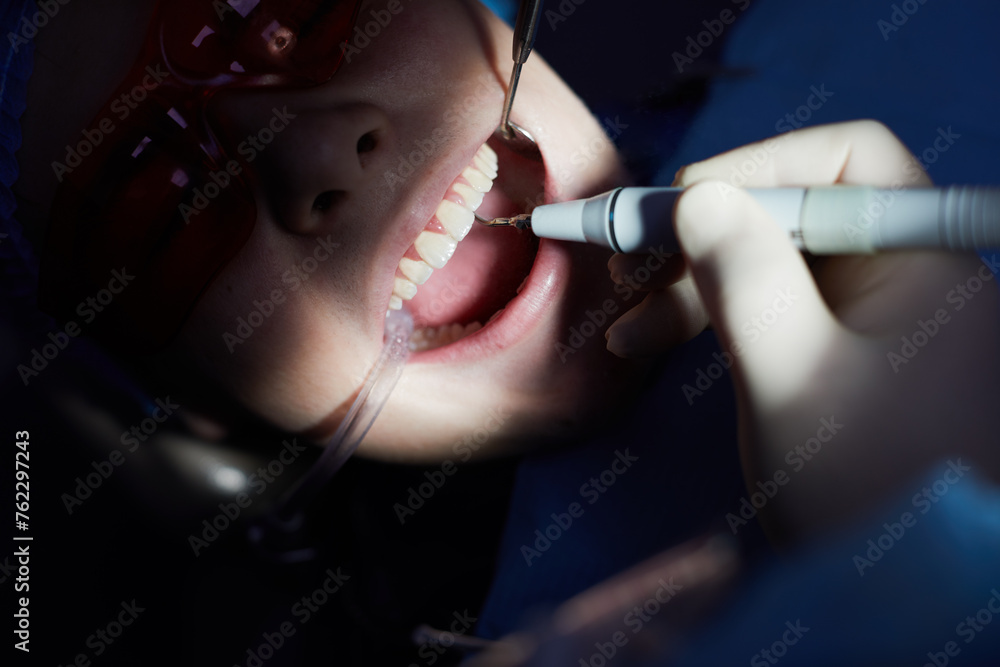 Dentist makes ultrasonic teeth cleaning to patient using special tools ...