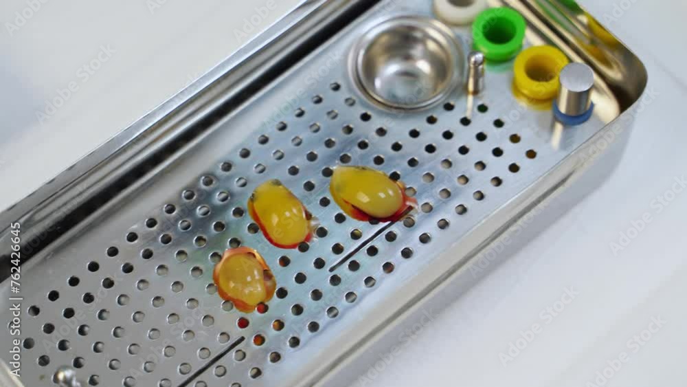 PRF membrane preparation. Fibrin clots on a perforated metal tray. PRF ...