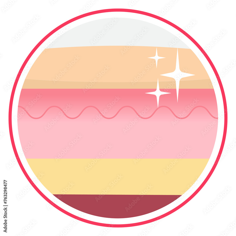 Normal Skin texture layer Infographic with Human skin layers diagram ...