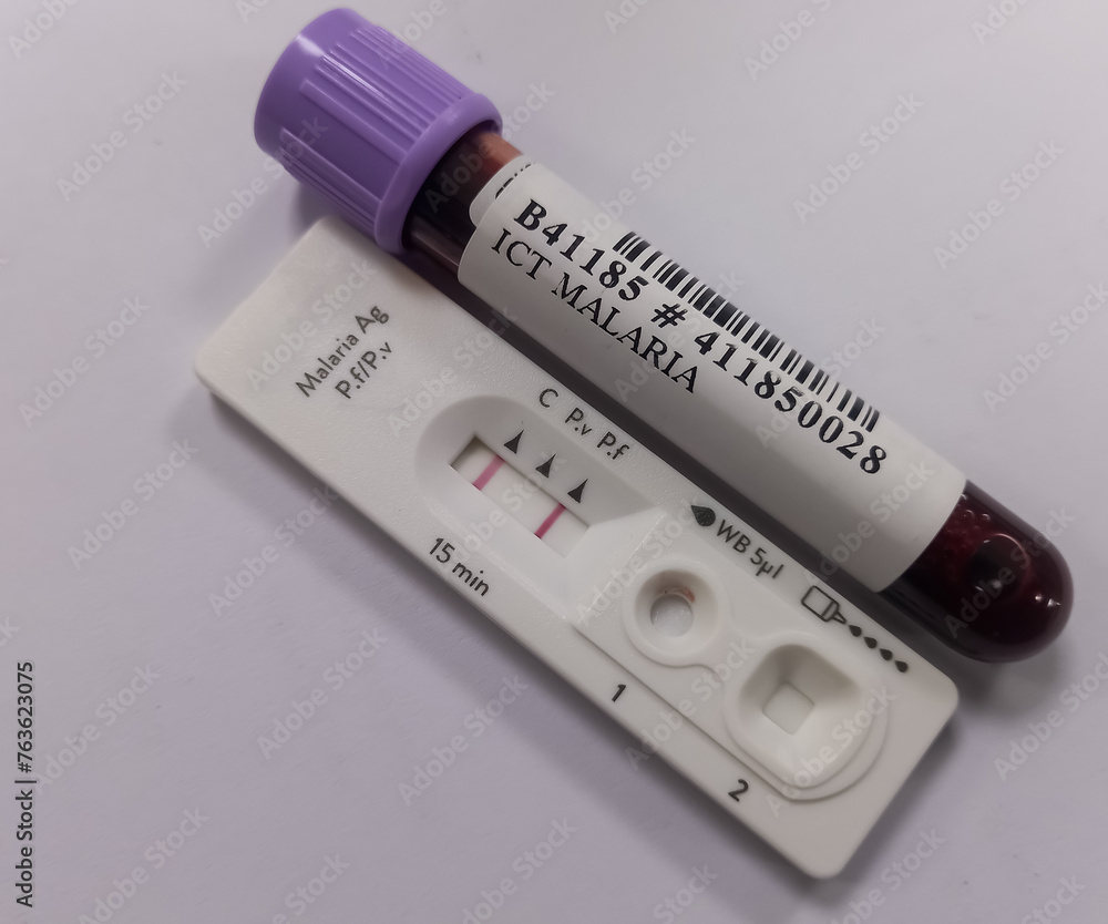 Malarial Parasite(MP) Test sample, Medical check up test, to identify ...