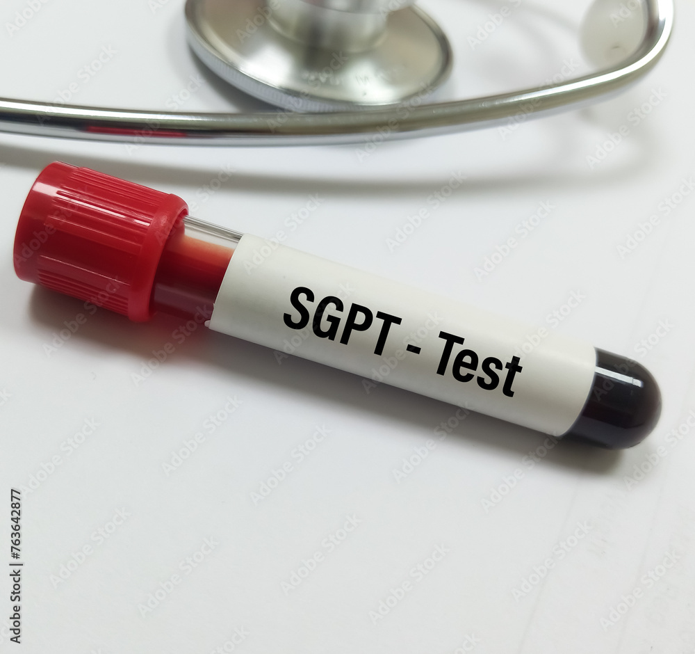 Blood sample for ALT (Alanine Transaminase) or SGPT test, liver ...