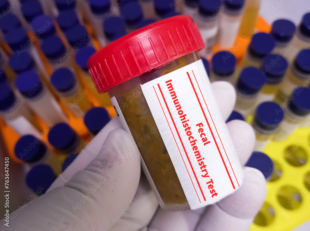 Stool Immunohistochemistry (IHC) Test, This test involves staining a ...