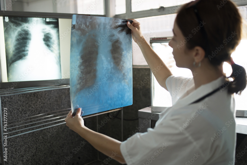Female doctor checking anatomy and physiology x-ray film of patient in ...
