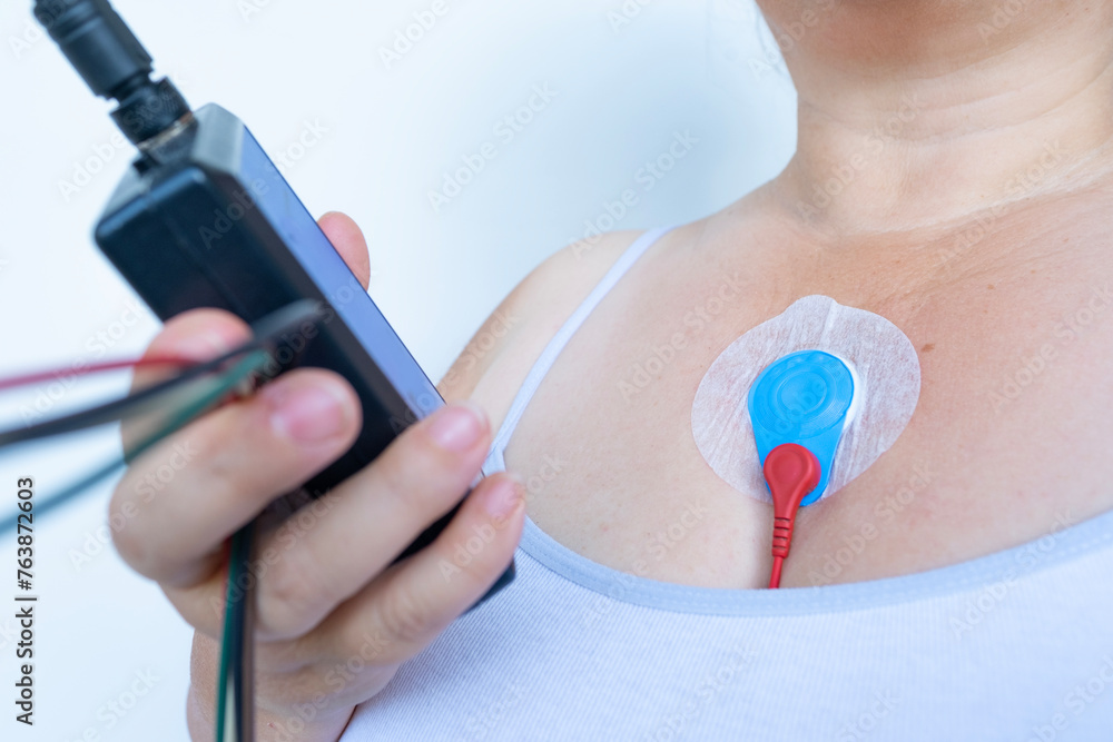 sensors on female body for Holter monitoring, woman with Holter monitor ... sensors on female body for Holter monitoring, woman with Holter monitor ...