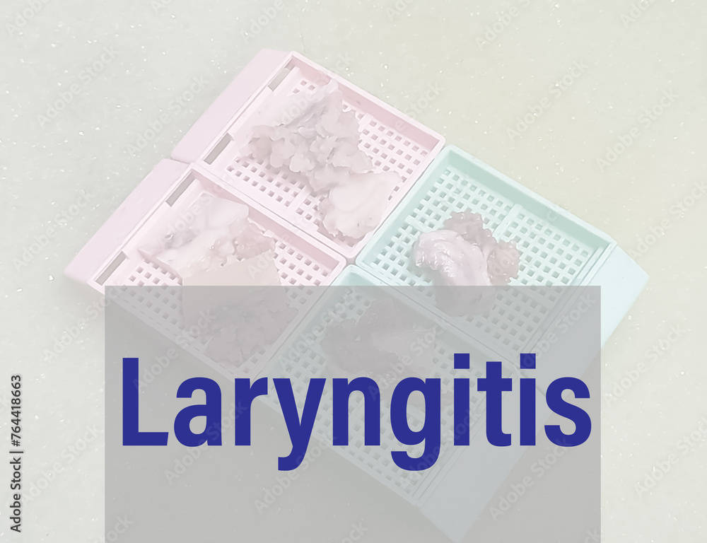 Laryngitis medical term with histology sample on cassette background ...
