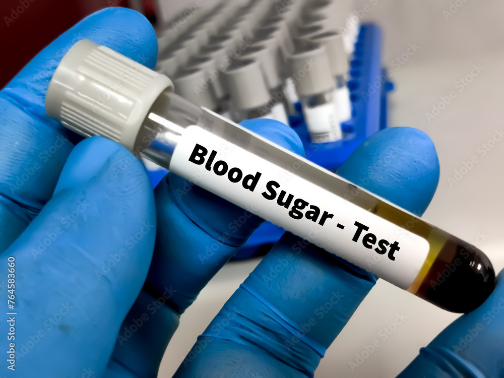 Blood sugar levels test with blood sample in vacuum test tube at ...