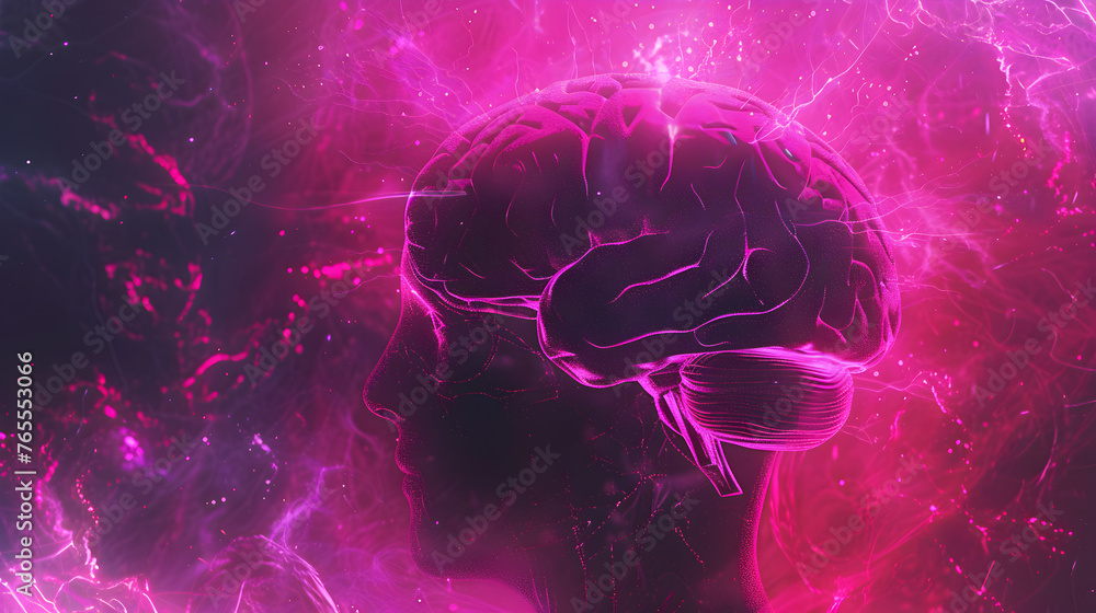 ภาพประกอบสต็อก MS brain MRI, with affected areas illuminated in bright ...