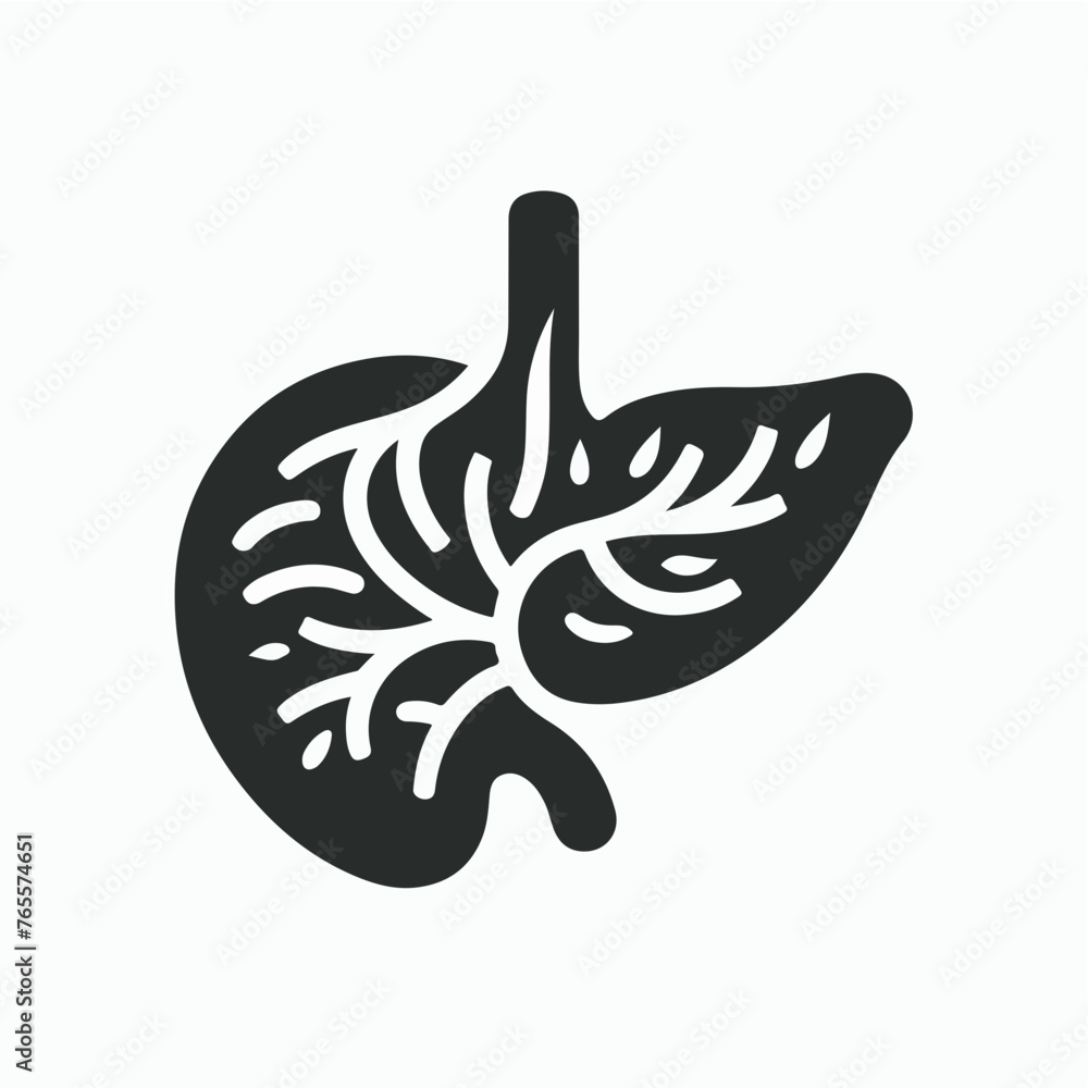 Gallstones in the gallbladder. Digestive organs. Liver. Stomach ...