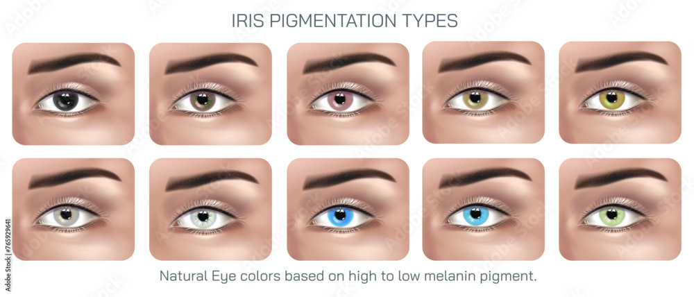 The amount and distribution of melanin in the iris determine the colour ...