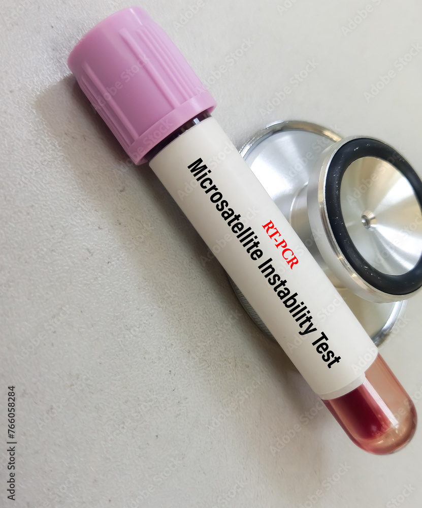 Blood sample for real time PCR Microsatellite Instability test, MSI ...