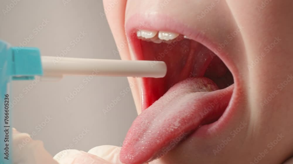 The child's sore throat may be treated with medication in the form of a ...