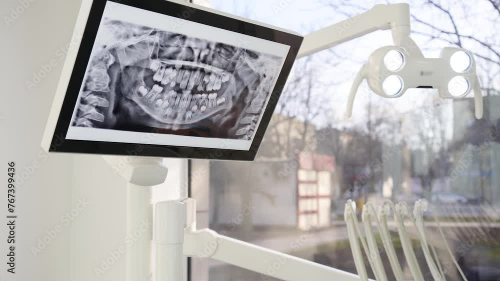 Close-up shot of panoramic x-ray of milk teeth on the screen in modern ...