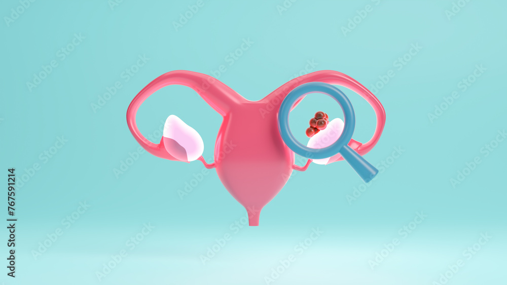 World Day of Ovarian Cancer, May 8, uterus reproductive system, Ovarian ...