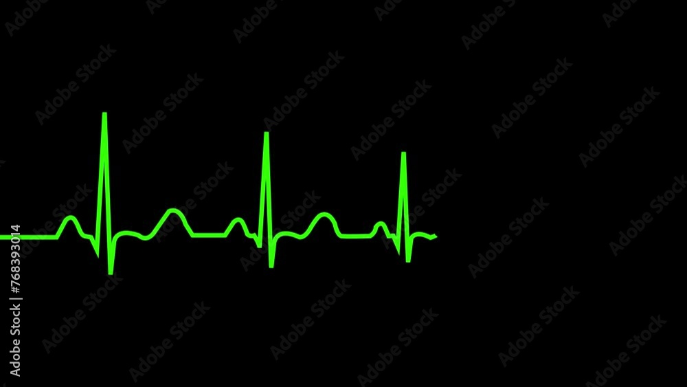 Heartbeat rate animation. Pulse footage. Heart beat 4k, 60 fps. Pulsing ...