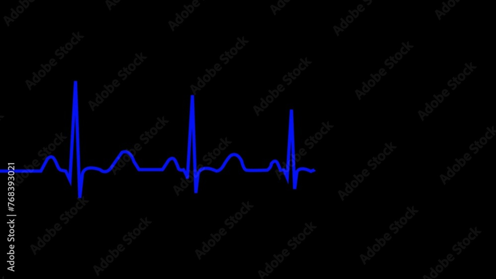 Heartbeat rate animation. Pulse footage. Heart beat Pulsing beat ...