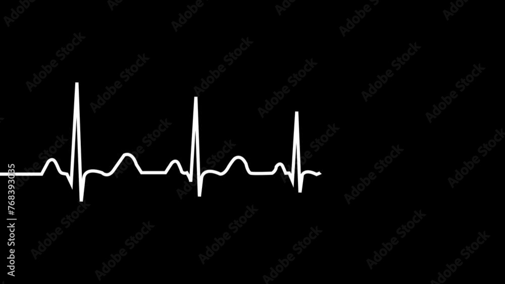 Heart Beating Moving Clip Art