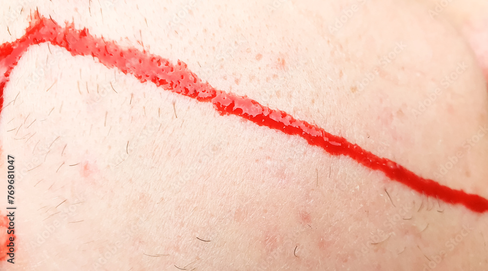 Bleeding from the head. Dripping blood on the man's face. Blood, wound ...