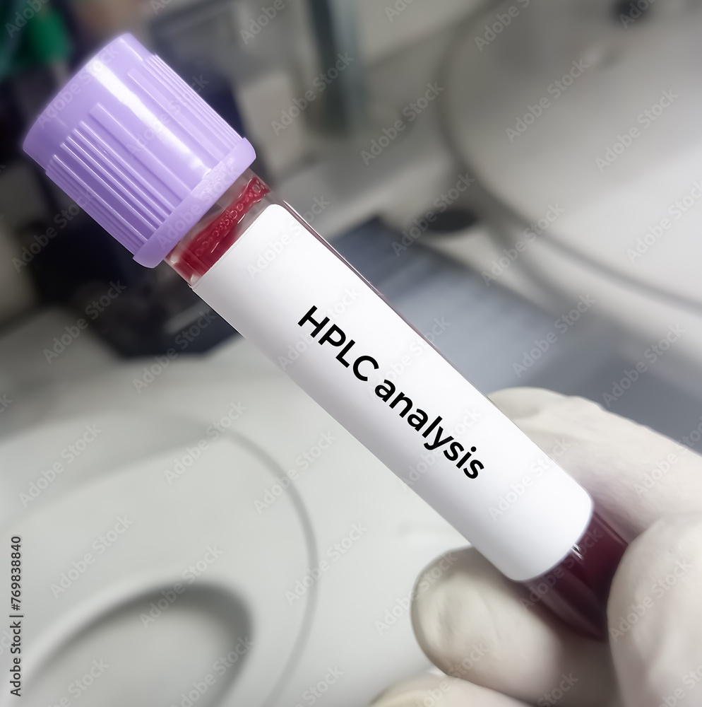 Blood sample tube for HPLC (High Performance Liquid Chromatography ...