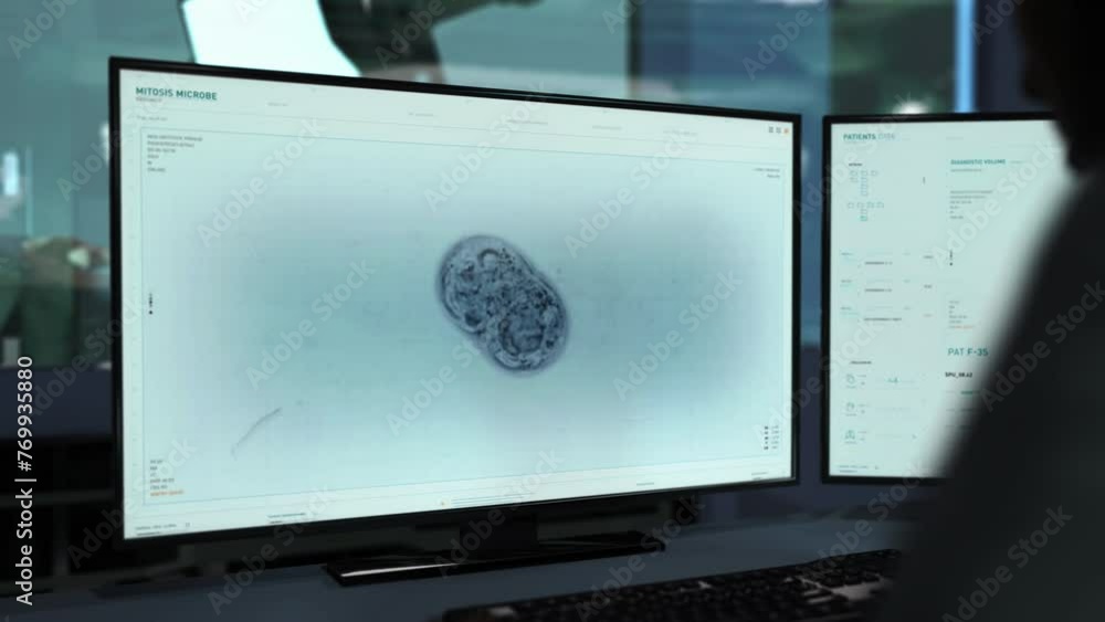 Scientist Using Innovative Microscope Software To See Mitosis Of ...