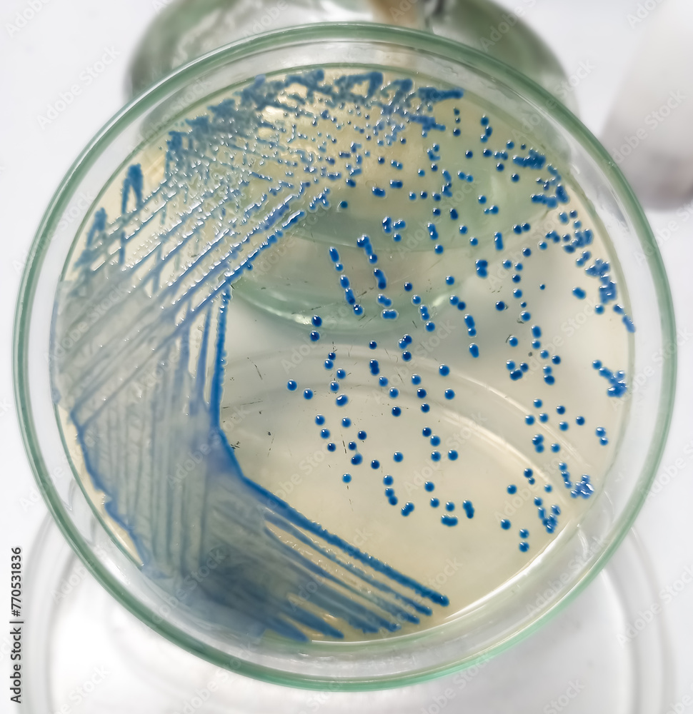 Growing Enterobacter spp bacteria in chromogenic agar medium in ...