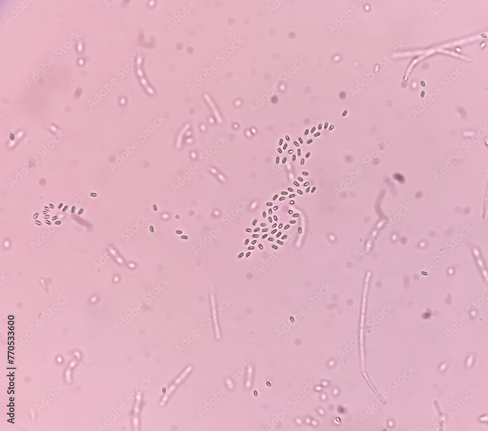 Microscopic image from fungus colonies at Sabouraud Dextrose Agar (SDA ...