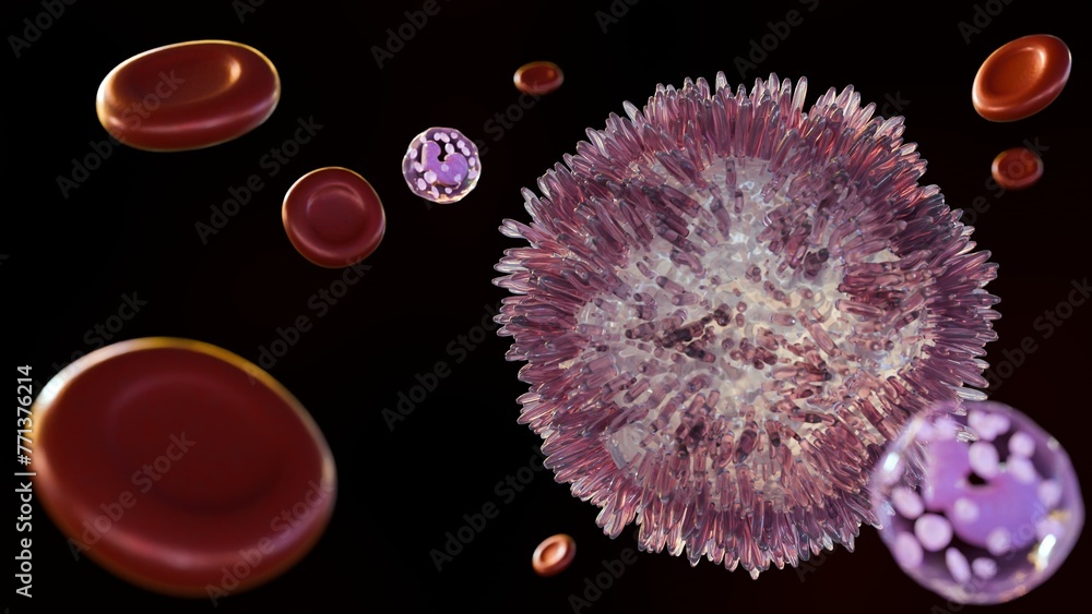 3d rendering of Hairy cell leukemia (HCL) is a rare type of chronic ...