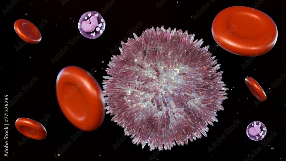 3d rendering of Hairy cell leukemia (HCL) is a rare type of chronic ...