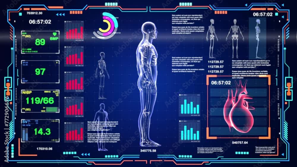 A computer monitor displays a human body with a heart and a skeleton ...
