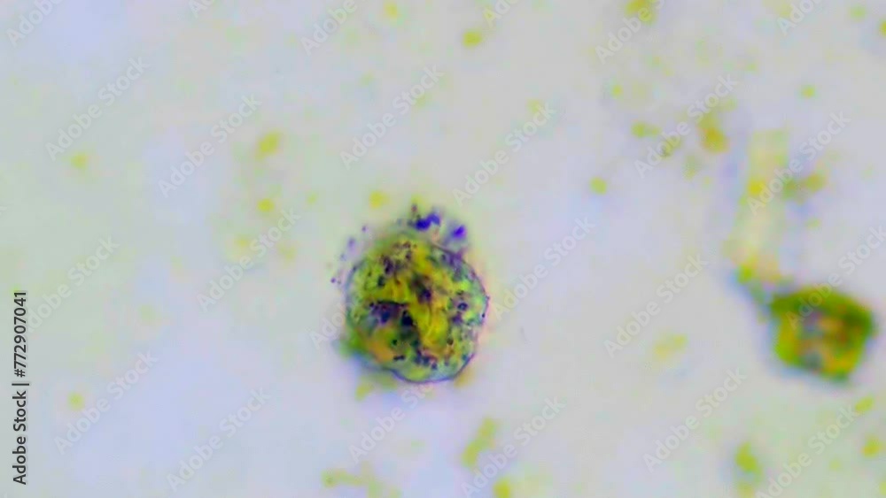 The explosion of life. Microorganisms under microscope. Organisms ...