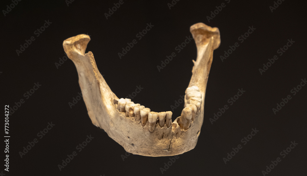 Antique human jawbone specimen on a dark background, indicative of ...