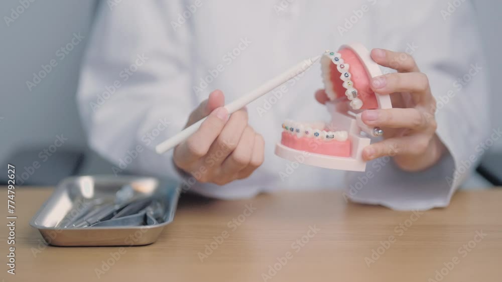 Dentist with Orthodontic tooth model and bracket or brace. Clean and ...