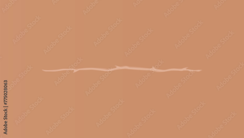 Healing wounds, skin scar, stitched gash and cut. Realistic surgical ...