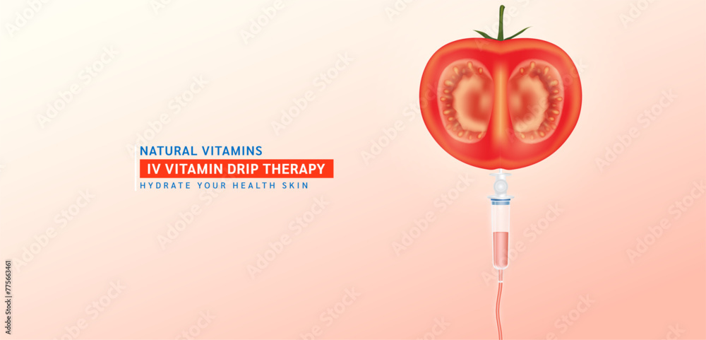 IV Vitamin Drip Therapy. Saline line and syringe is connected to the ...