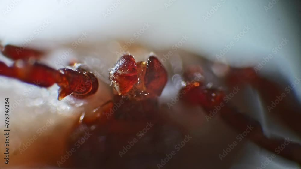 Extreme magnification of a tick's body, as it moves its limbs and ...