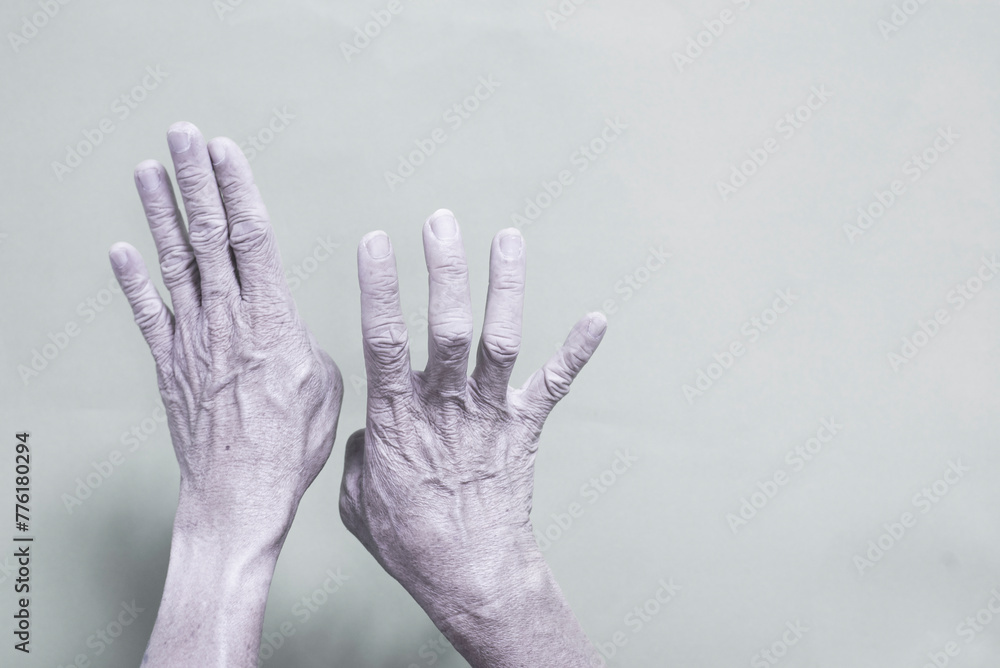 Symptoms of arthritis in the hands cramps in fingers or feel pain and ...