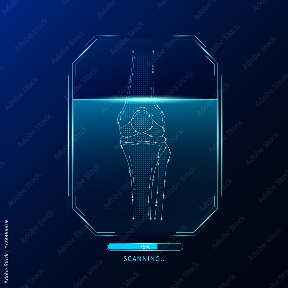 Knee joint bone scanning radar screen. Medical technology health care ...