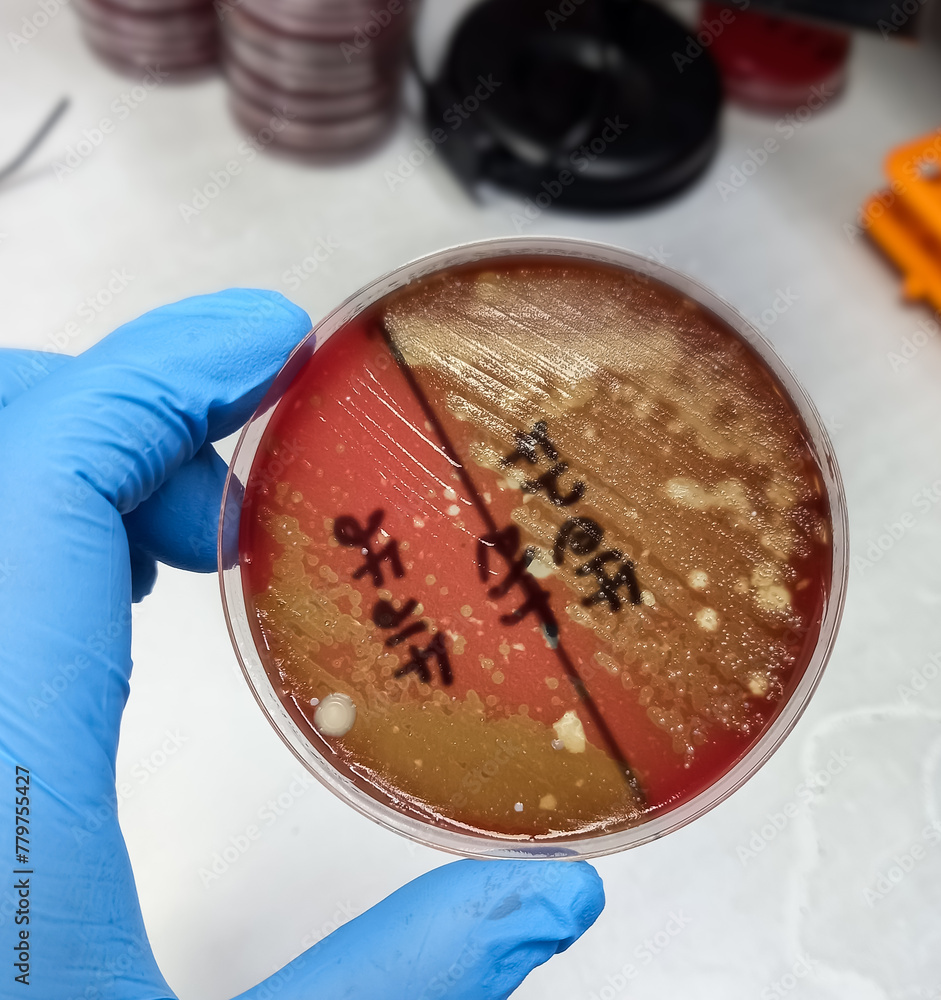 Streptococcus bacterial colonies with beta hemolytic on blood agar ...