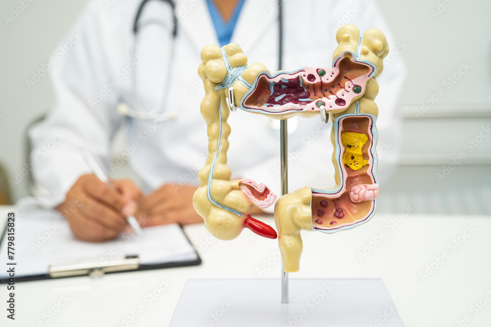 Intestine, appendix and digestive system, doctor holding anatomy model ...