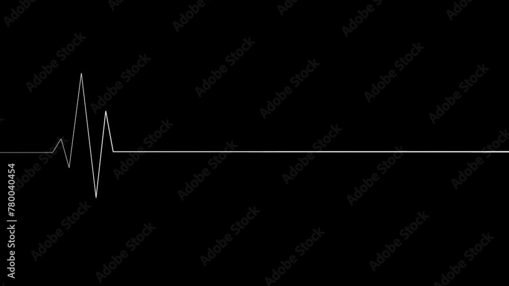 ECG cardiogram oscilloscope. Heartbeat line showing.Heart beat ...