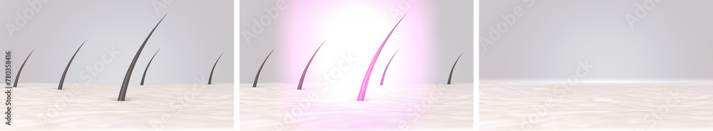 Skin before and after laser hair removal process. 3d rendered ...