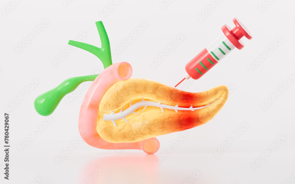 Human pancreas, gall bladder organ model, pancreatitis and drug therapy ...