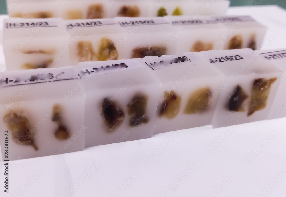 Histology paraffin embedded tissue block making at medical laboratory ... Histology paraffin embedded tissue block making at medical laboratory ...